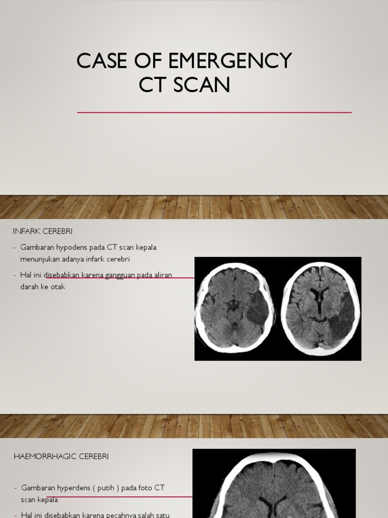 Case of Emergency CT Scan | PDF