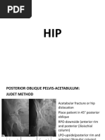 Sacrum and Coccyx X-Ray Positioning Guide | PDF | Pelvis | Anatomical ...