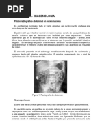 Signos de neumoperitoneo en radiografías | PDF | Abdomen | Hígado