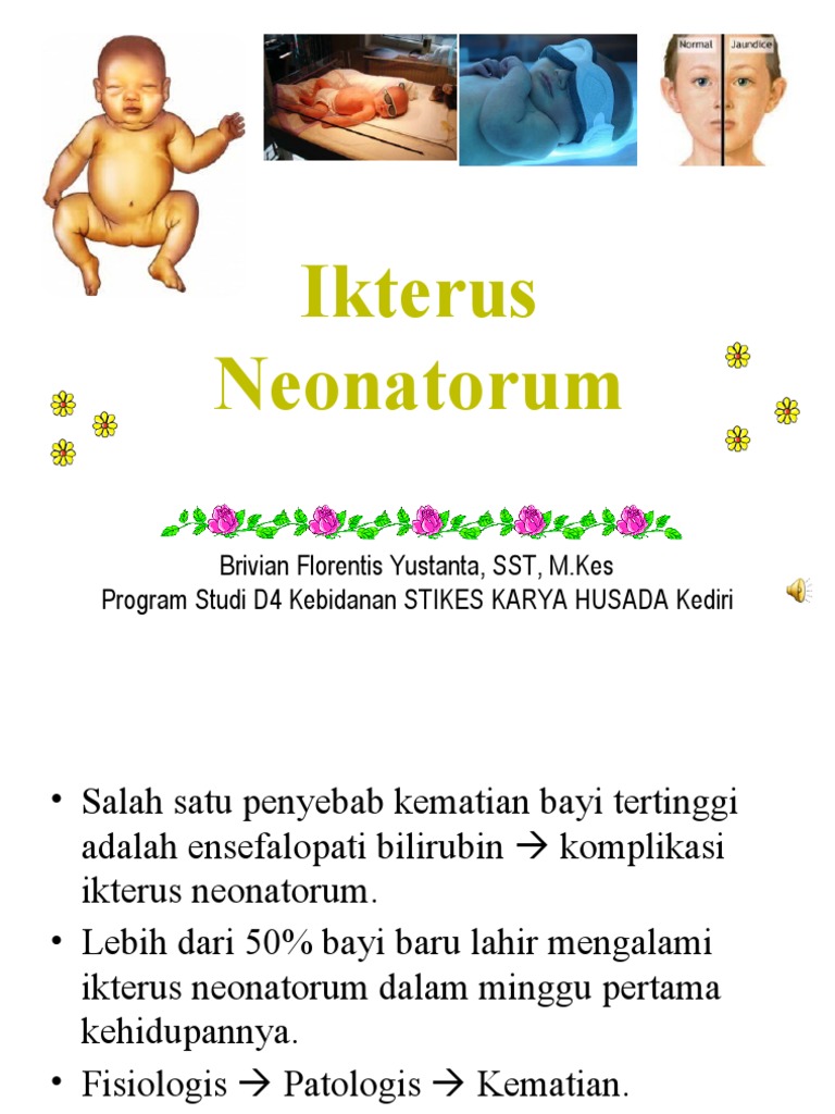 Ikterus Neonatorum | PDF