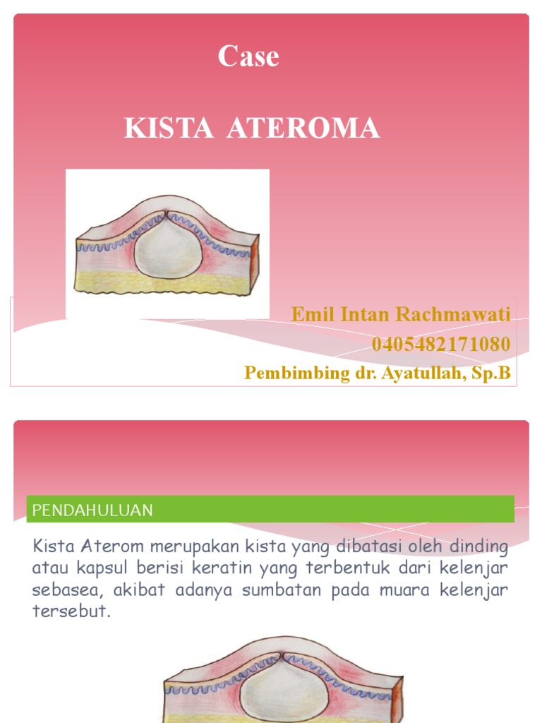 Ateroma Fix | PDF