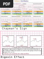 Osmosis ECG EKG Book | PDF | Electrocardiography | Atrium (Heart)