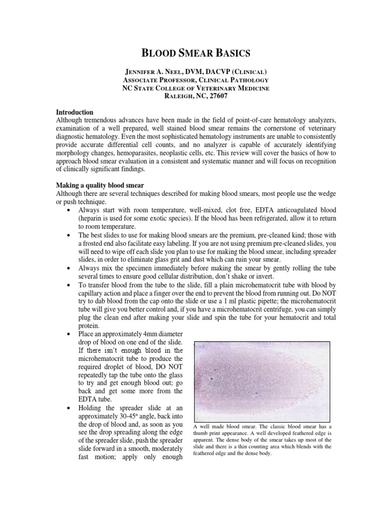 Blood Smear Basics 2016 | PDF | White Blood Cell | Red Blood Cell