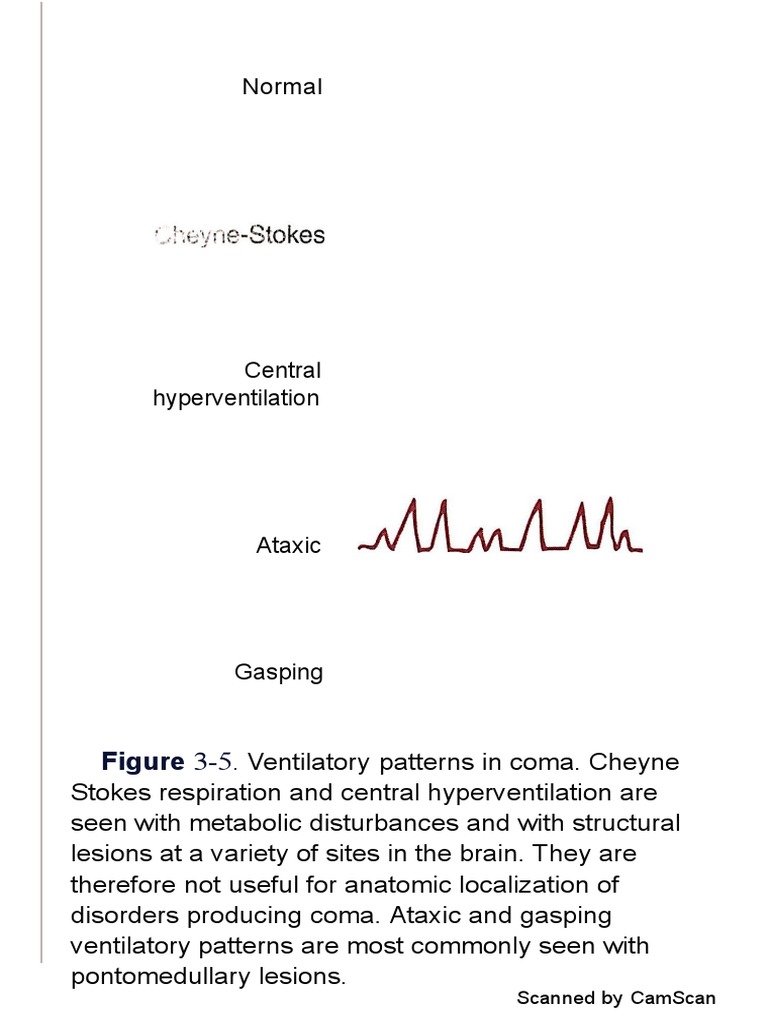 Normal: Scanned Camscan Ner | PDF | Coma | Neuroscience