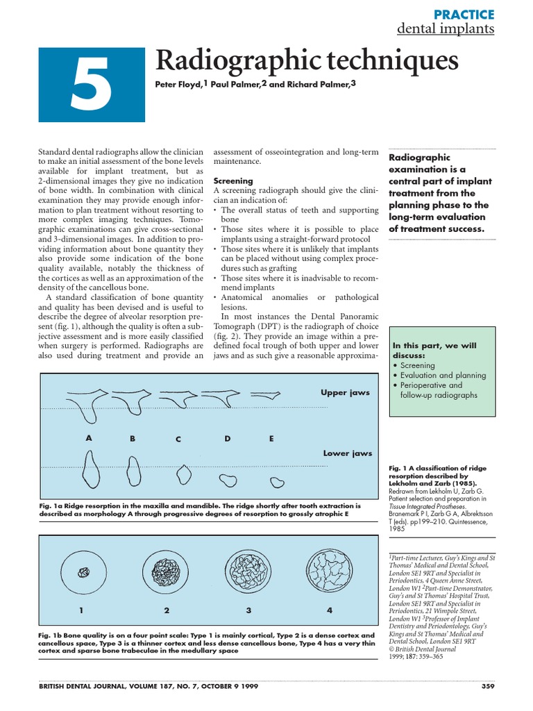 5 Radiographic Techniques | Download Free PDF | Ct Scan | Dental Implant