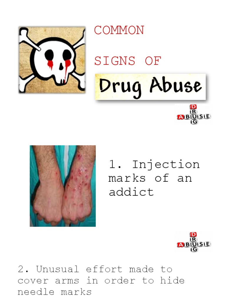 Signs of Drug Addiction: Injection Marks, Mood Changes & More | PDF