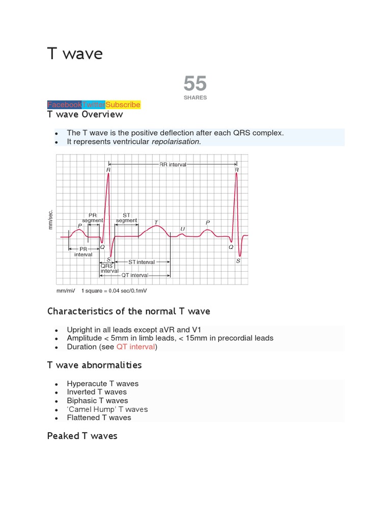 T Wave | PDF | Myocardial Infarction | Electrocardiography