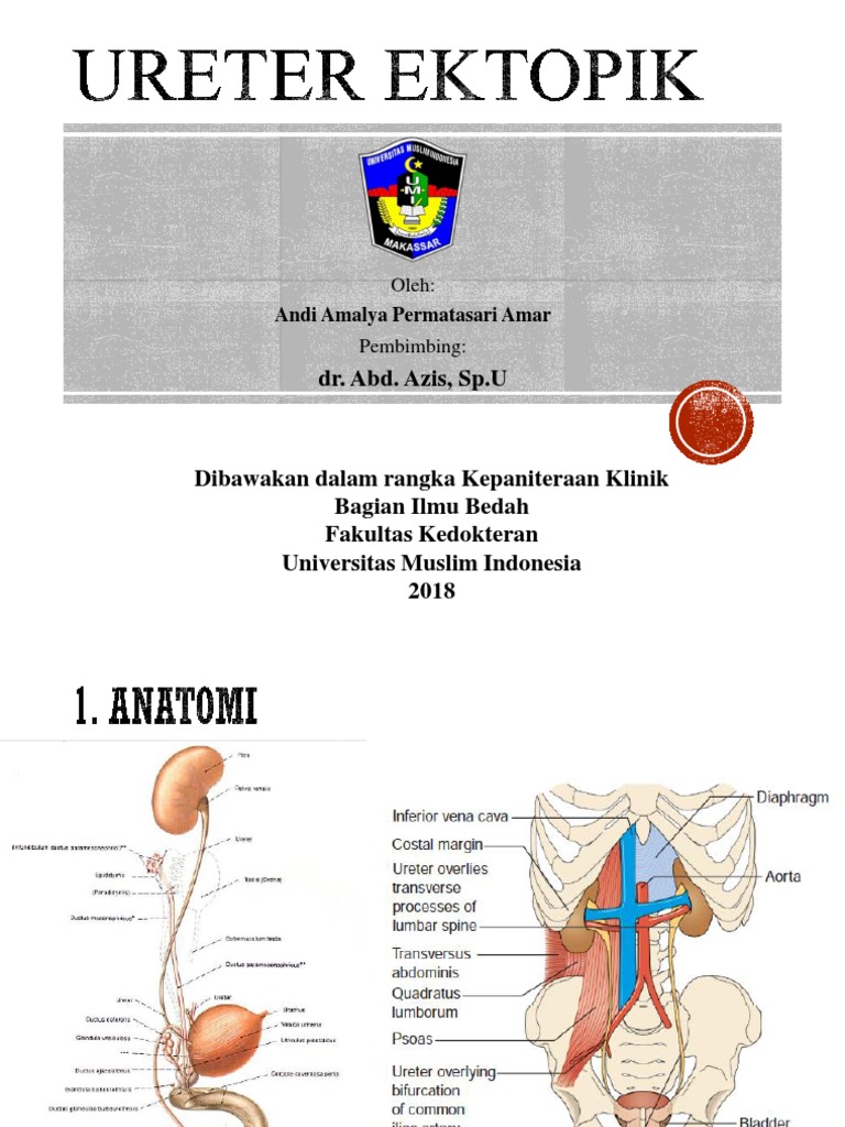 Ureter Ektopik: Definisi dan Anomali | PDF | Kesehatan Holistik | Sains ...