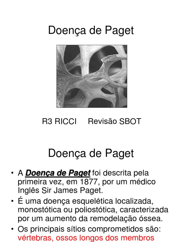 Doença De Paget Odontologia | Doença de Paget dos Ossos: o que é, e ...