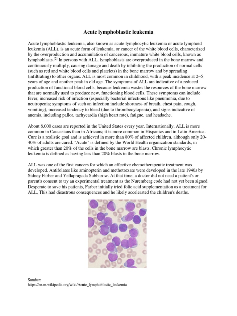Understanding Acute Lymphoblastic Leukemia | PDF | Science & Mathematics