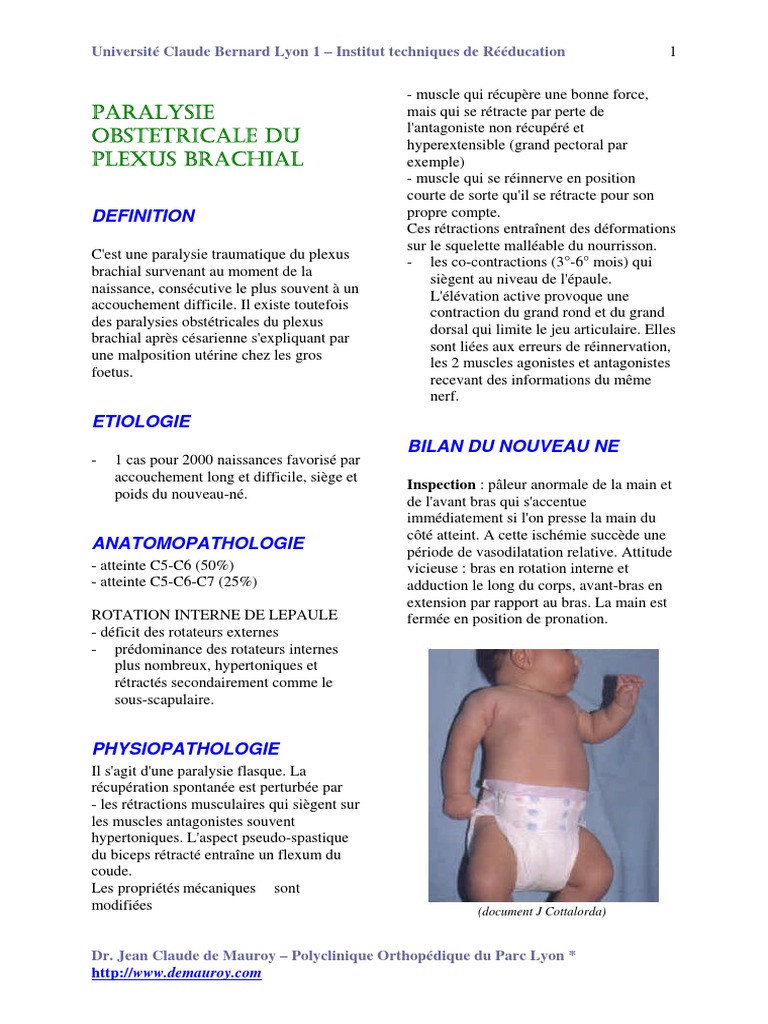 Paralysie Obstetricale Du Plexus Brachial (P.o.p.b) | Coude | Main