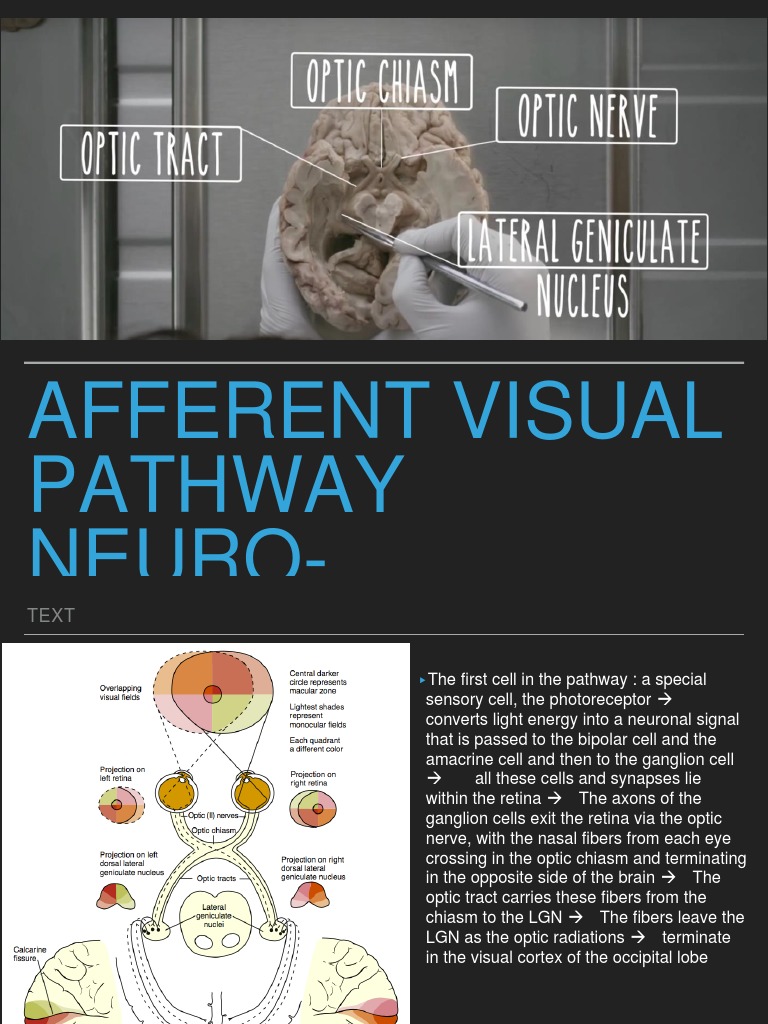 Afferent Visual Pathways of Neuro-ophthalmology - Ihsan | Visual System ...