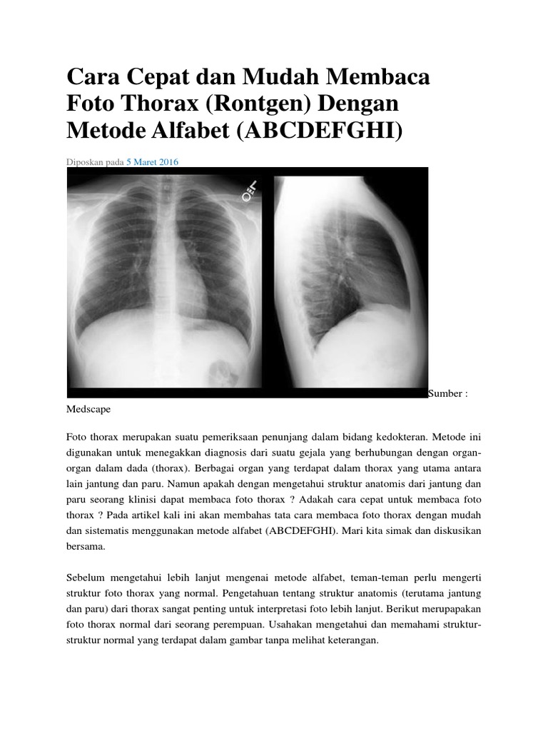 Cara Cepat Dan Mudah Membaca Foto Thorax | PDF