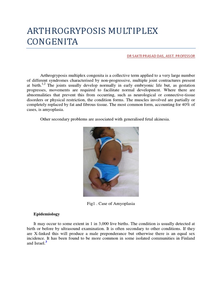 Arthrogryposis Multiplex Congenita-Dr S P Das | PDF | Congenital ...