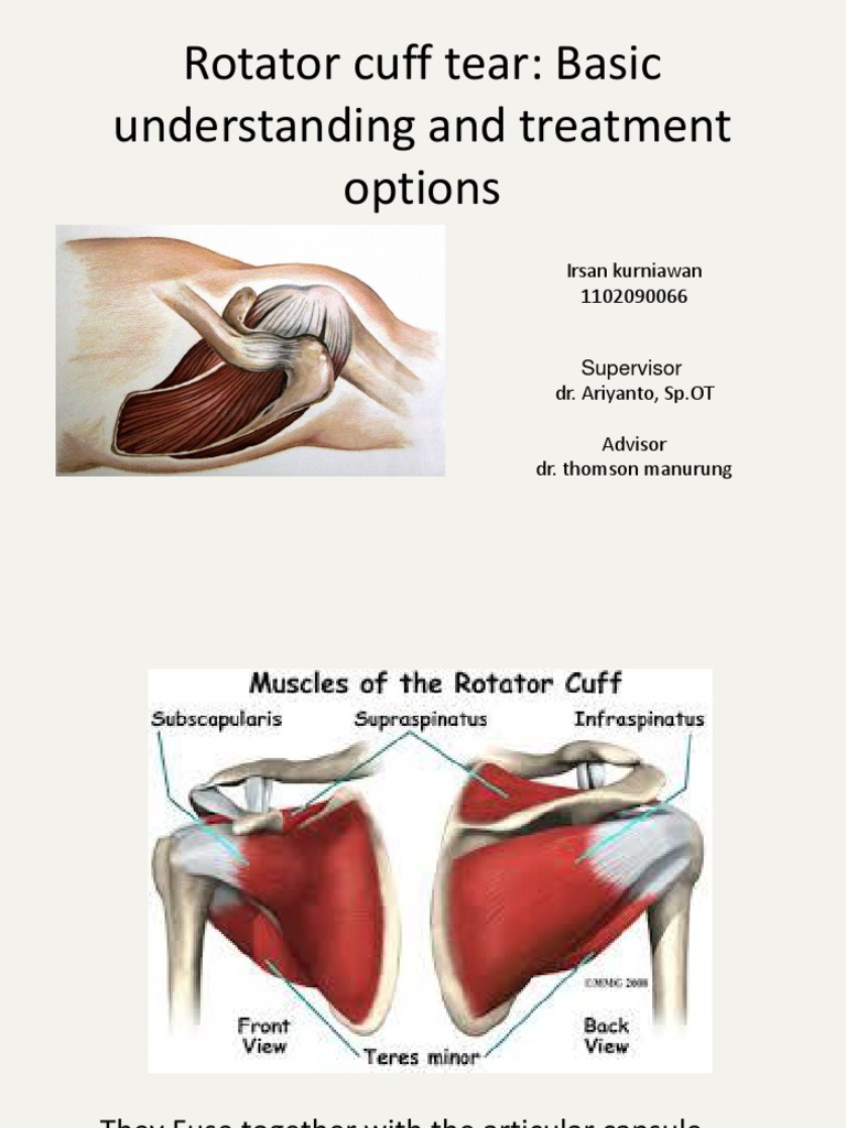 Rotator Cuff Tear: Basic Understanding and Treatment Options | PDF ...
