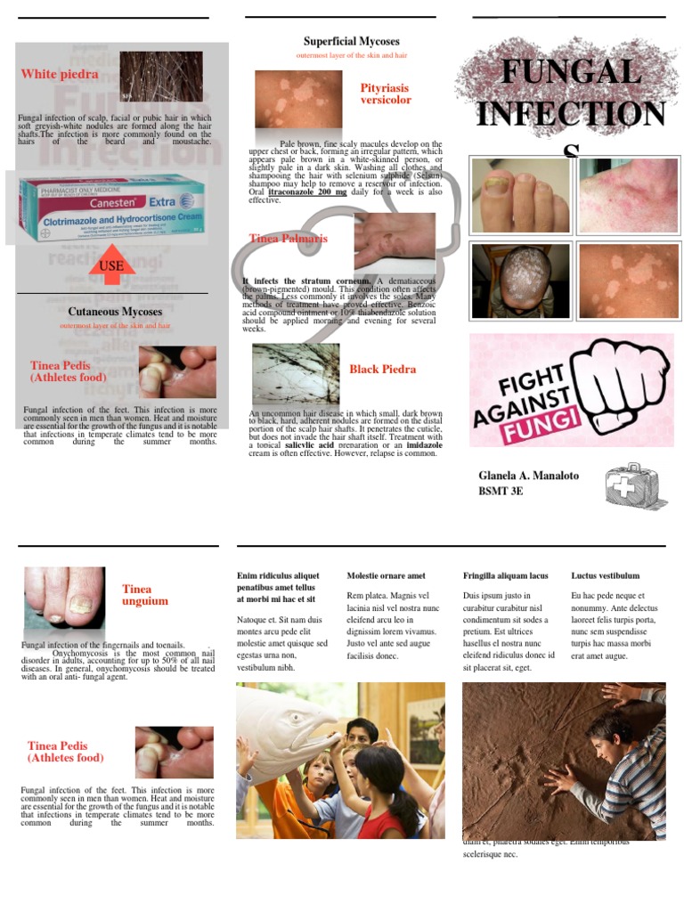 Fungal Infection S: White Piedra | PDF | Diseases And Disorders ...