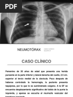 Ejemplo RX Torax Normal | PDF