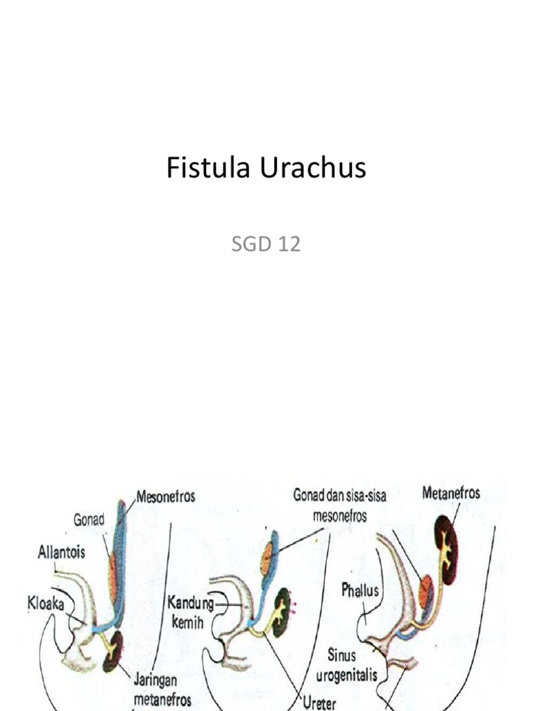 Fistula Urachus | PDF | Perjalanan