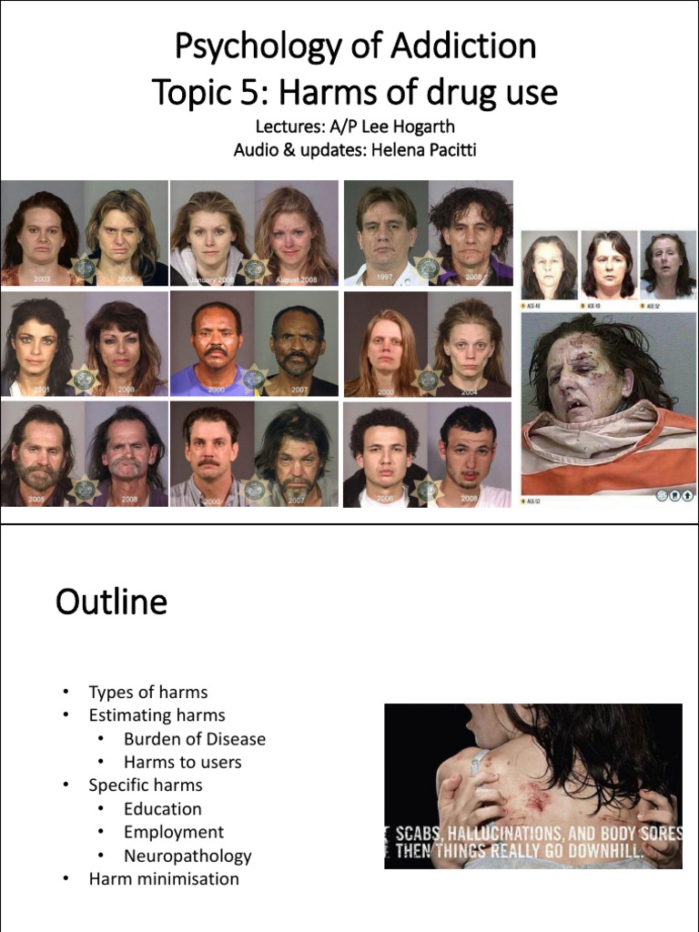 Psychology of Addiction Topic 5: Harms of Drug Use: Lectures: A/P Lee ...