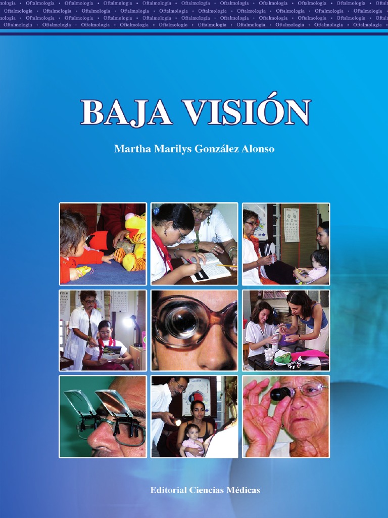 Baja Vision Completo PDF | PDF | Percepción visual | Ojo humano