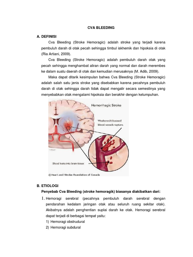 Cva Bleeding | PDF