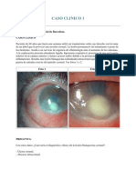Anatomía Del Seno Camerular | PDF | Glaucoma | Visión