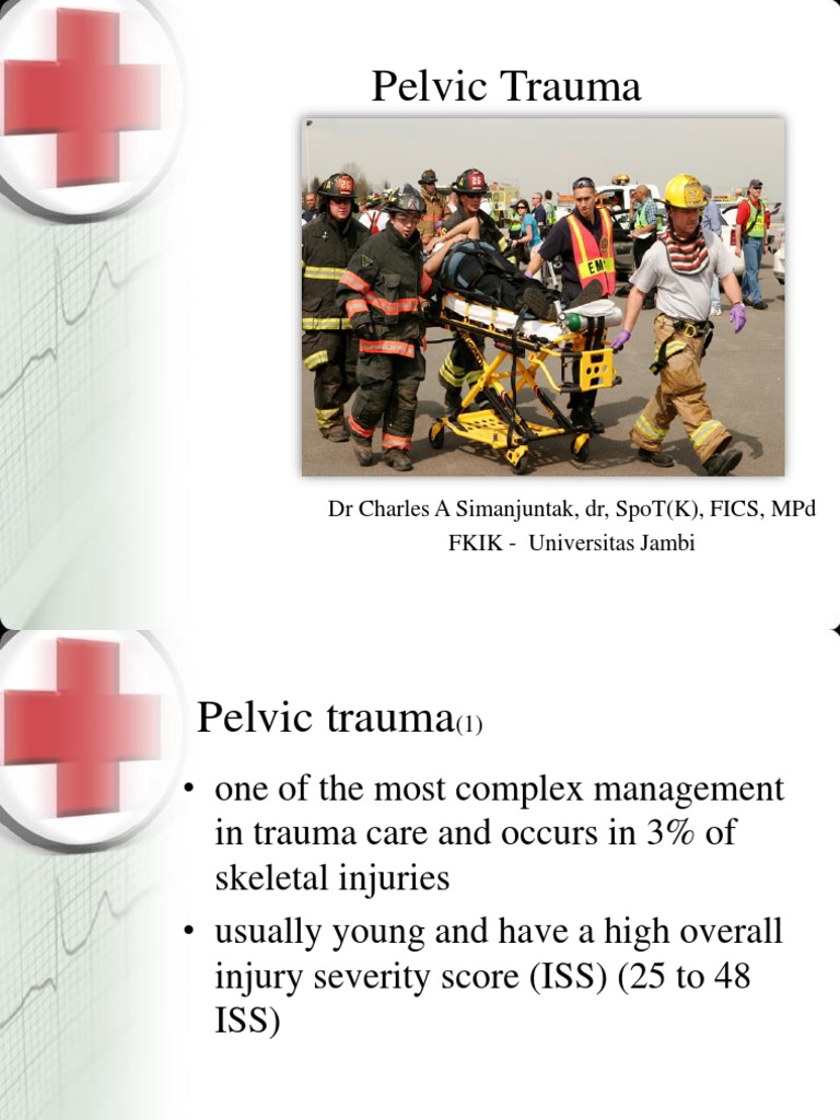 Pelvic Trauma: DR Charles A Simanjuntak, DR, Spot (K), Fics, MPD Fkik ...
