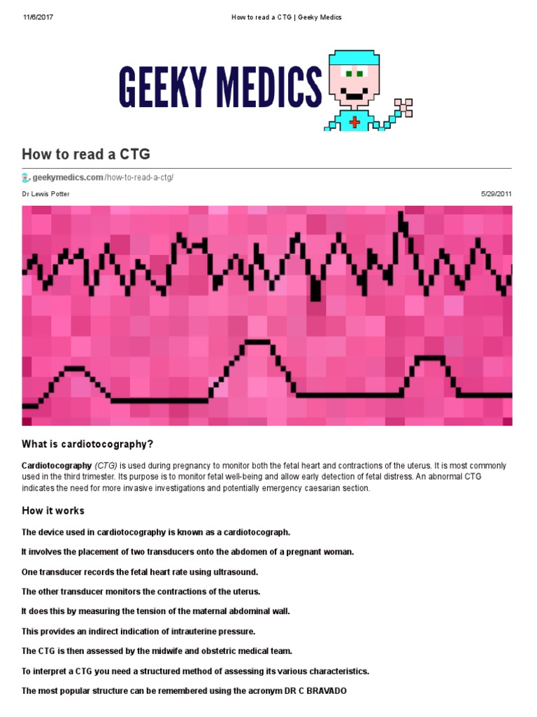 How to Read a CTG _ Geeky Medics | Heart Rate | Fetus
