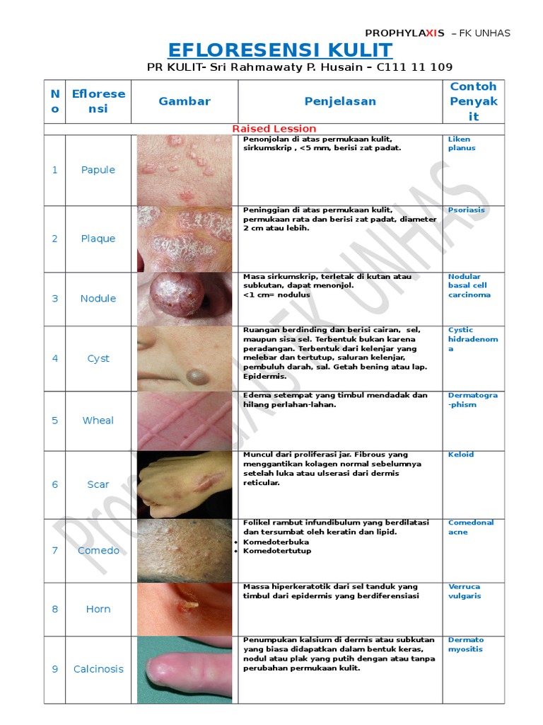EFLORESENSI KULIT Fitzpatrick Disertai Gambar Yayu | PDF