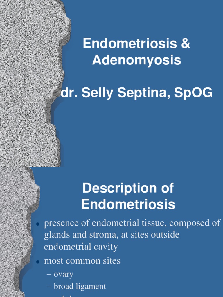 Endometriosis And Adenomyosis Dr Selly Septina Spog Pdf