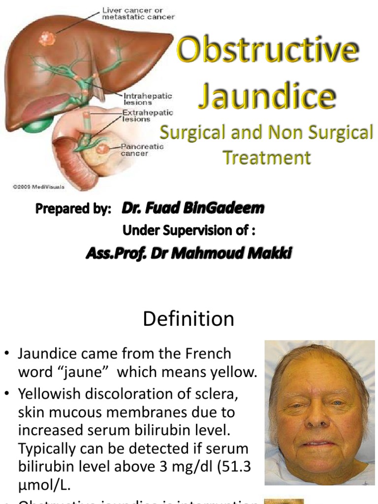 Obstructive Jaundice | PDF | Organ (Anatomy) | Medicine