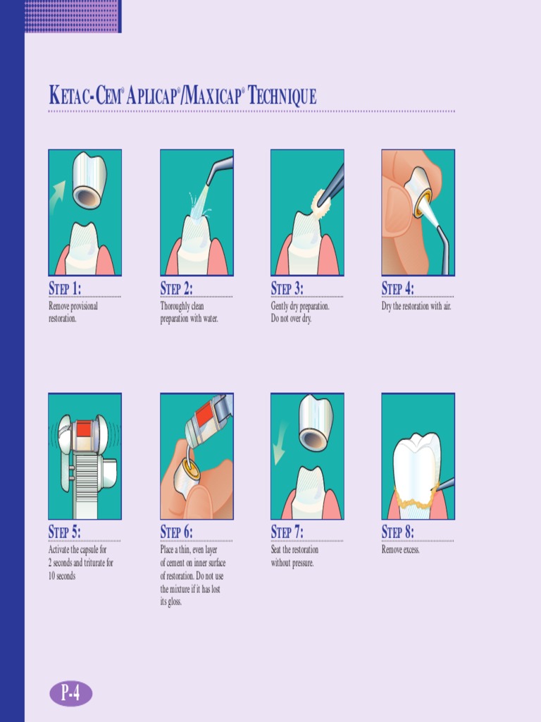 Ketac Cem Aplicap | PDF | Industrial Processes | Industries