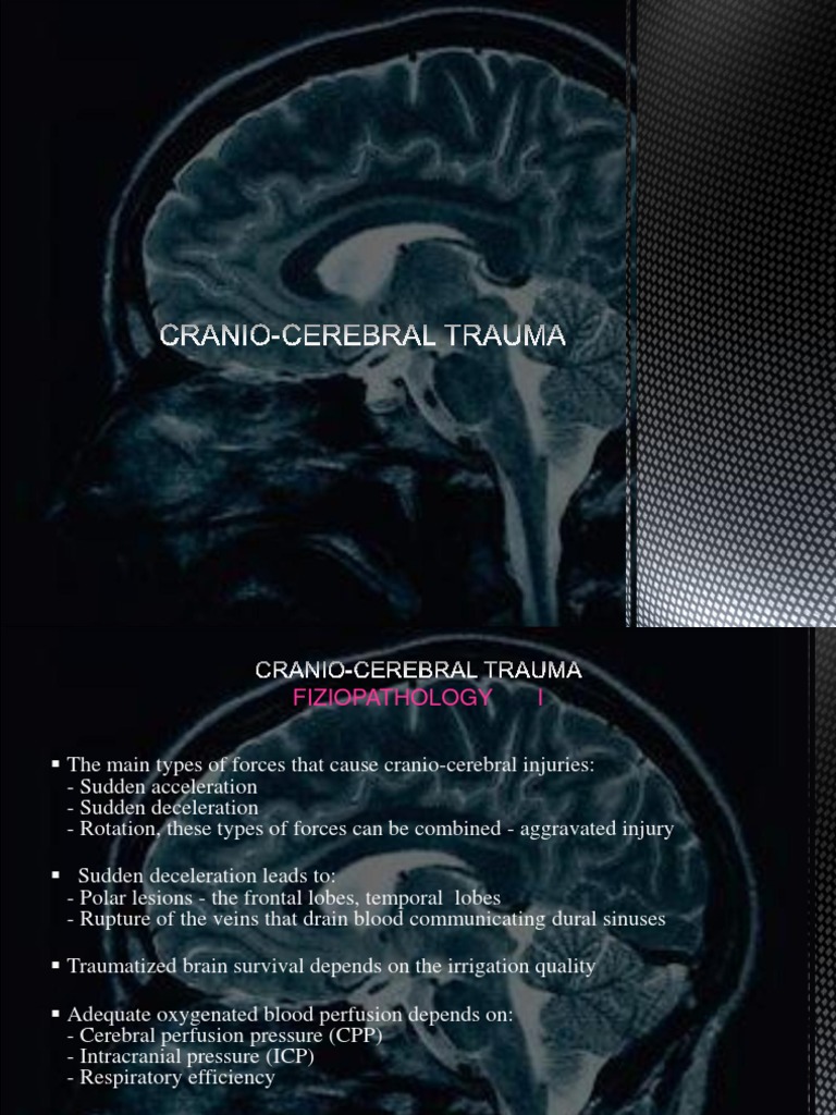 Cranio Cerebral Trauma | Medical Specialties | Clinical Medicine