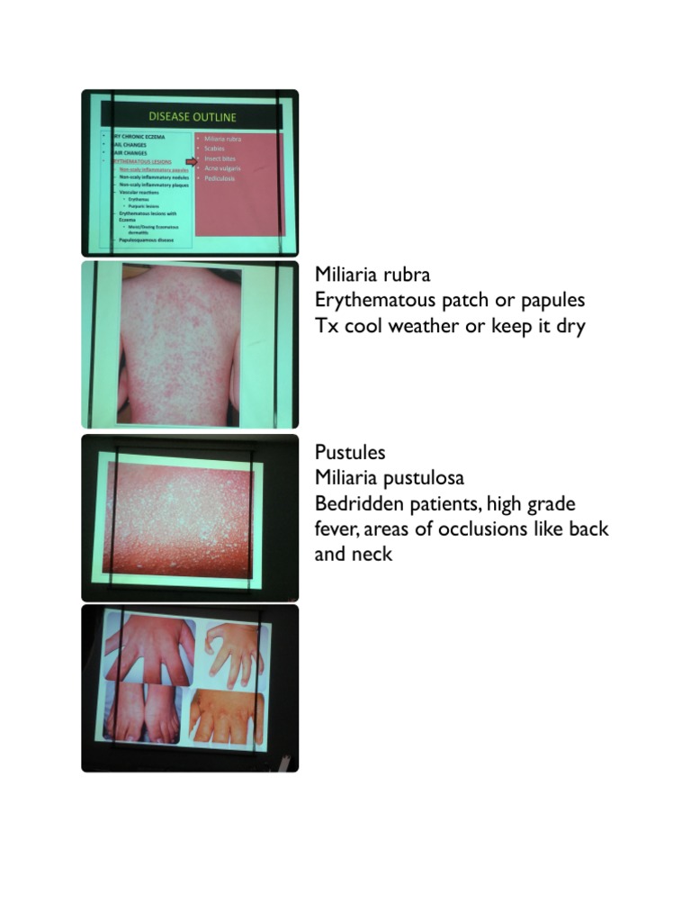 Erythematous Lesions PDF-notes 201610271601 | PDF | Dermatology ...