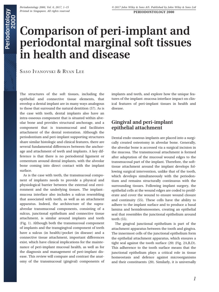 Comparison of Peri-Implant and Periodontal Marginal Soft Tissues in ...