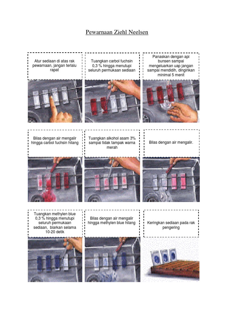 Pewarnaan Ziehl Neelsen | PDF