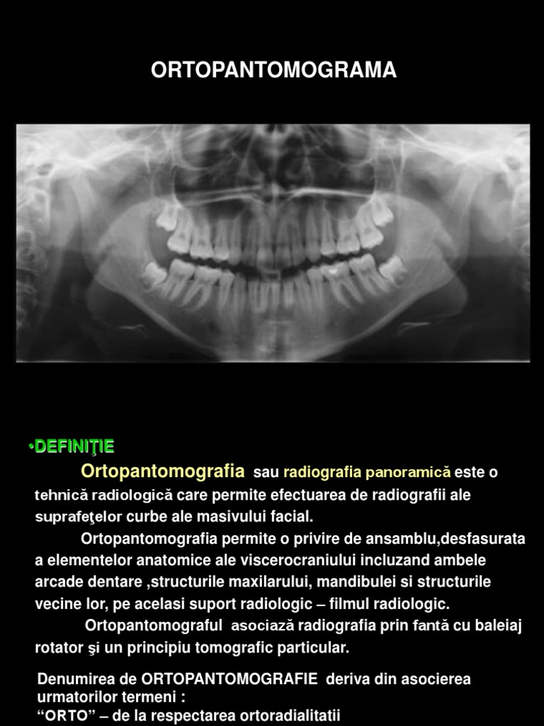 LP 3 Opg 1 | PDF