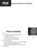 Step-by-Step FESS Surgical Guide | PDF | Human Nose | Human Head And Neck