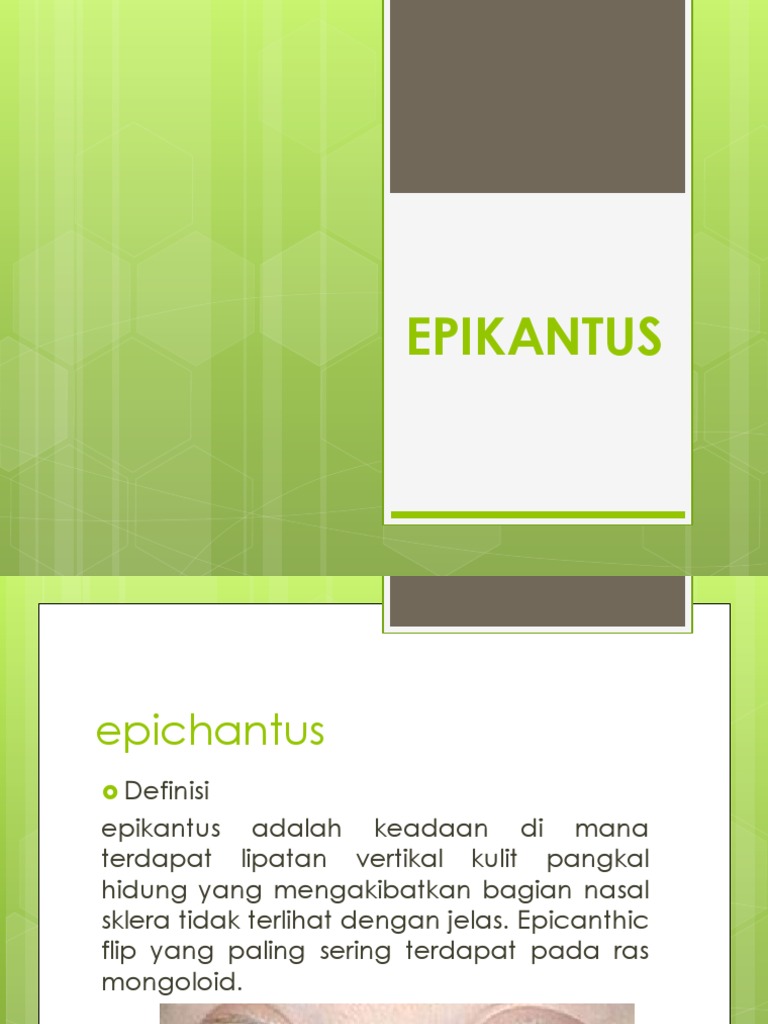 Epikantus | PDF