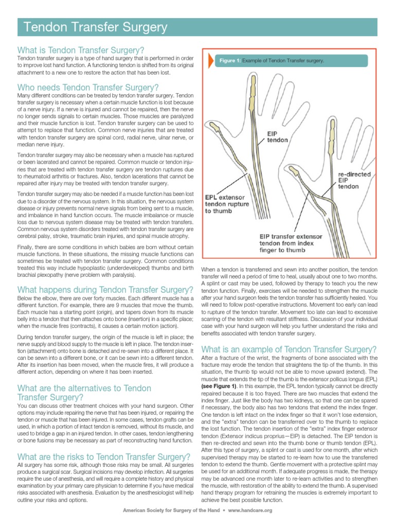 Tendon Transfer | Finger | Surgery