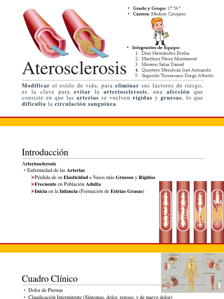 Prevención y Diagnóstico de Aterosclerosis | PDF | Sistema circulatorio ...
