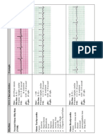 Basic Arrhythmia Rules | PDF | Electrocardiography | Physiology