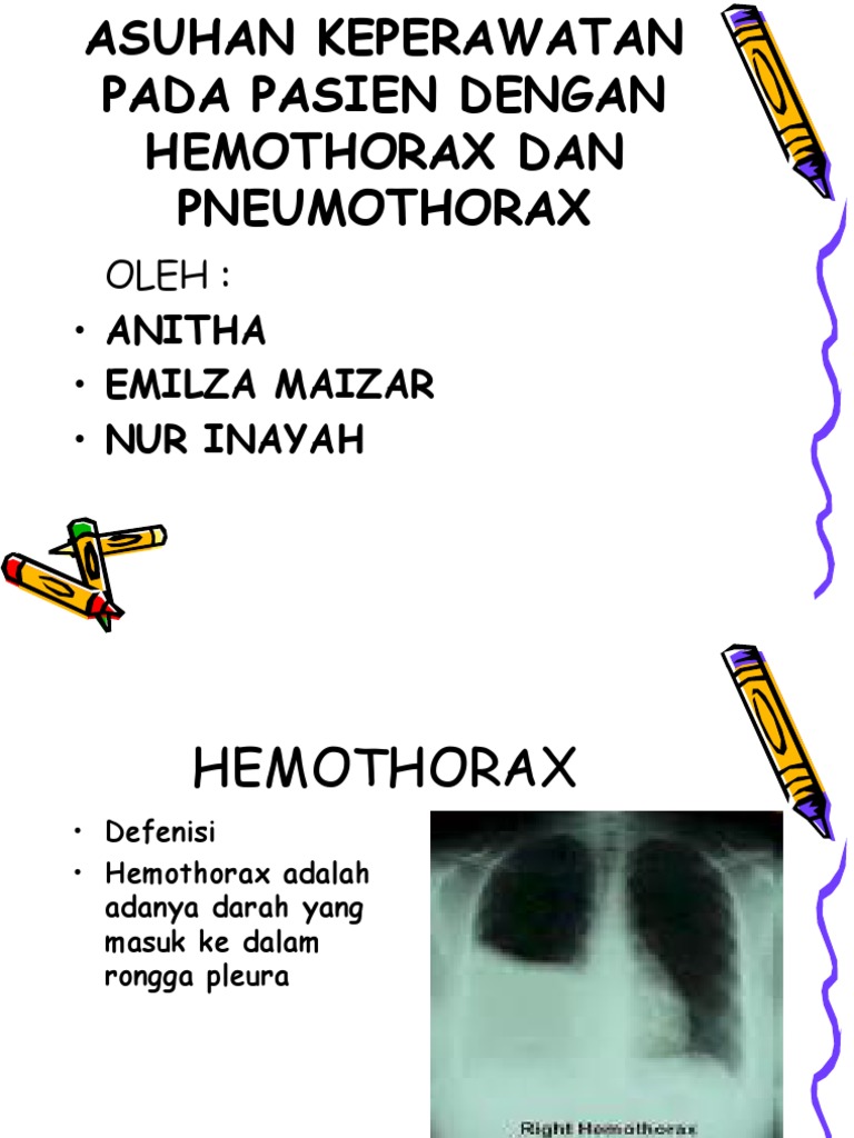 Hemothorax | PDF