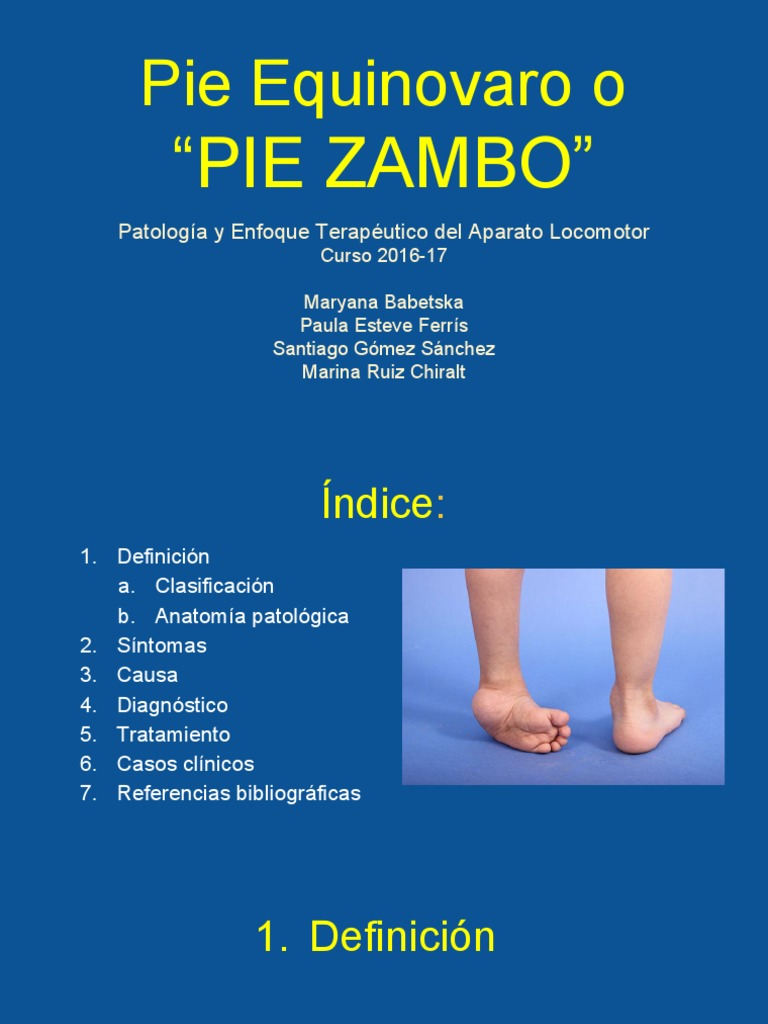 Pie Equinovaro o "PIE ZAMBO" PDF | PDF