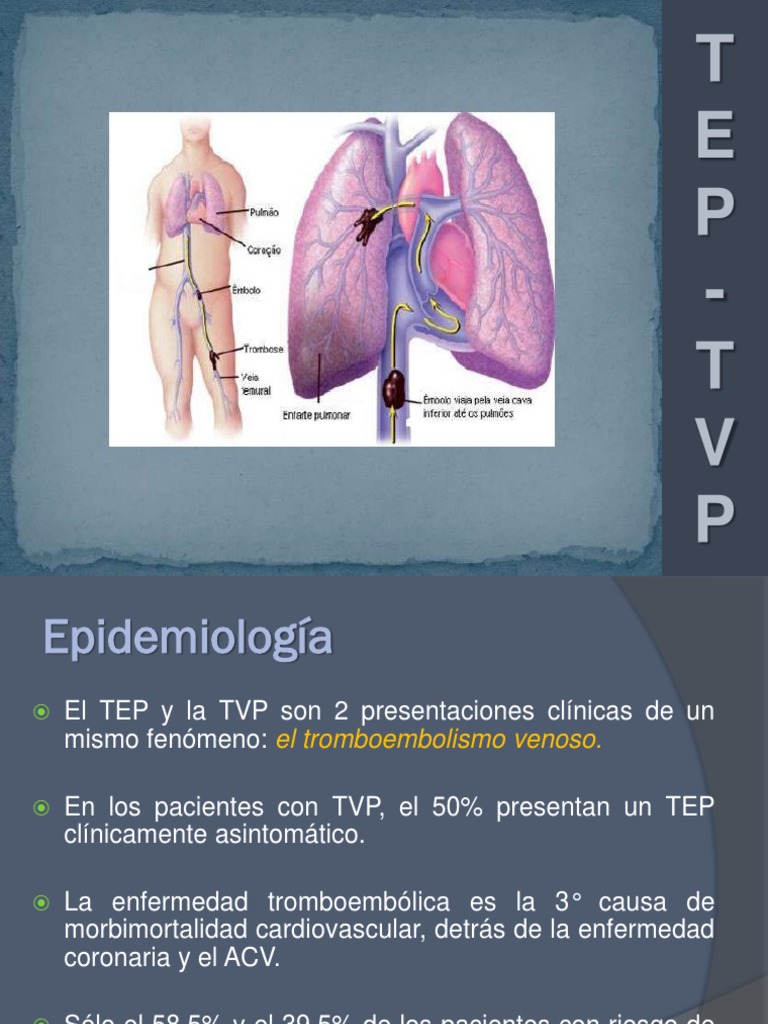 Tep - TVP | PDF | Medicina CLINICA | Especialidades Medicas