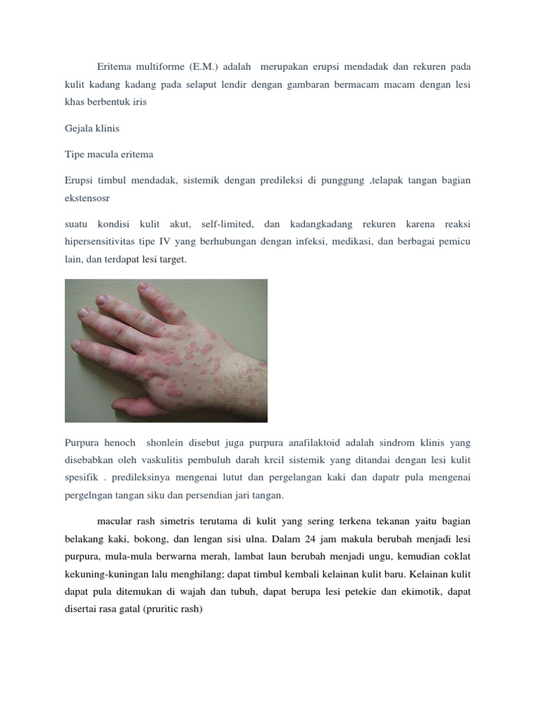 Eritema Multiforme | PDF