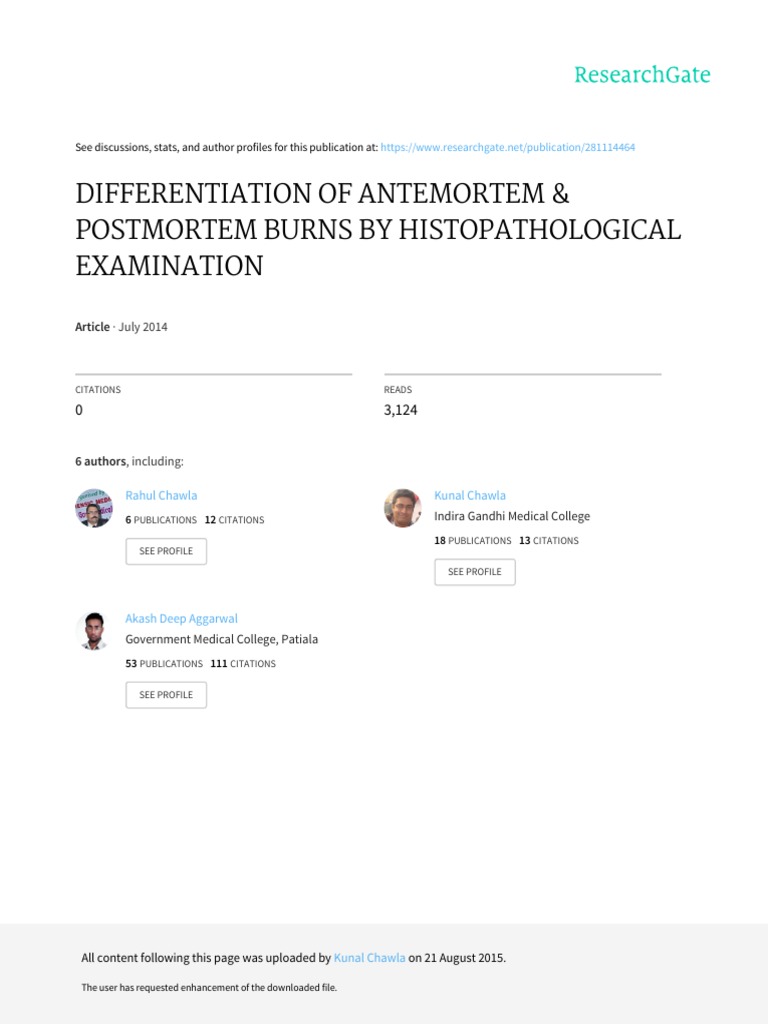 Differentiation of Antemortem & Postmortem Burns by Histopathological ...
