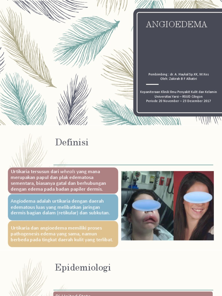 ANGIOEDEMA | PDF