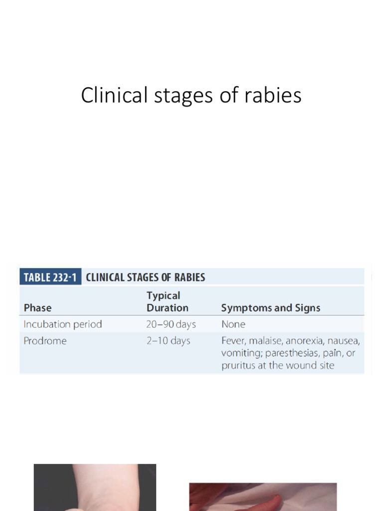Clinical Stages of Rabies | PDF