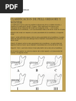 Clasificación de Pell y Gregory | PDF